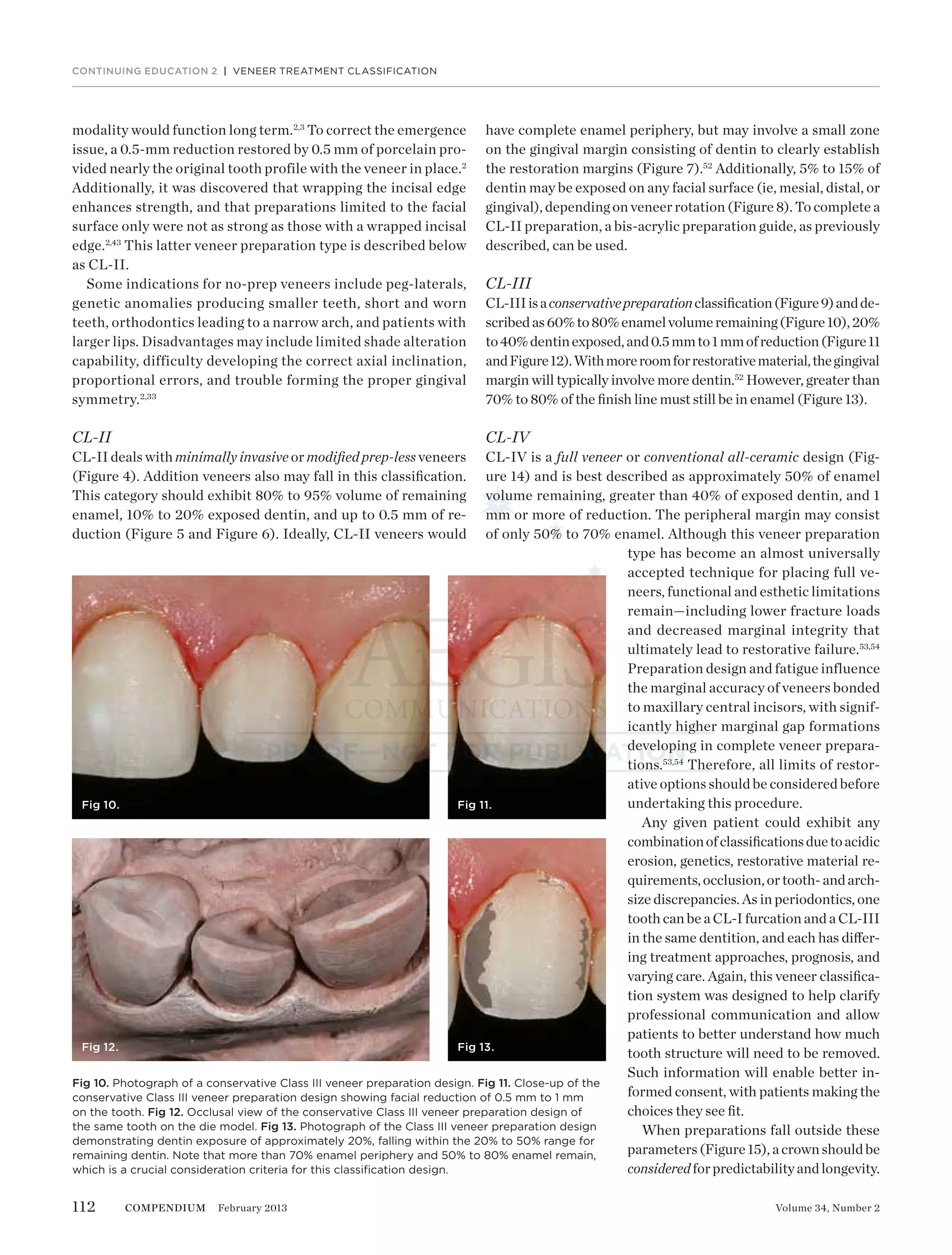 Veneer classification .pdg