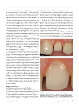Veneer classification .pdg