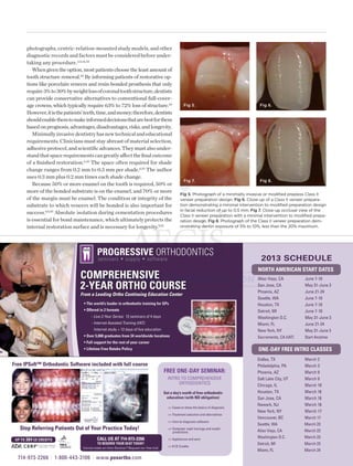 Veneer classification .pdg