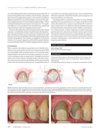 Veneer classification .pdg