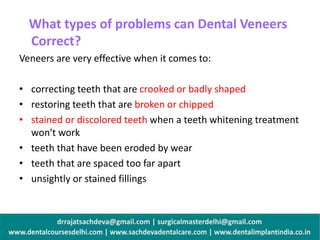 Veneers | composite veneering | porcelain veneering | smile designing ...