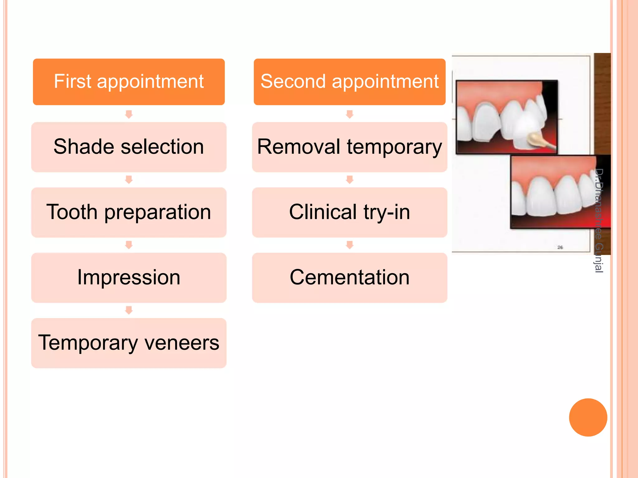 Veneers Dr. Dhanashree Gunjal | PPTX