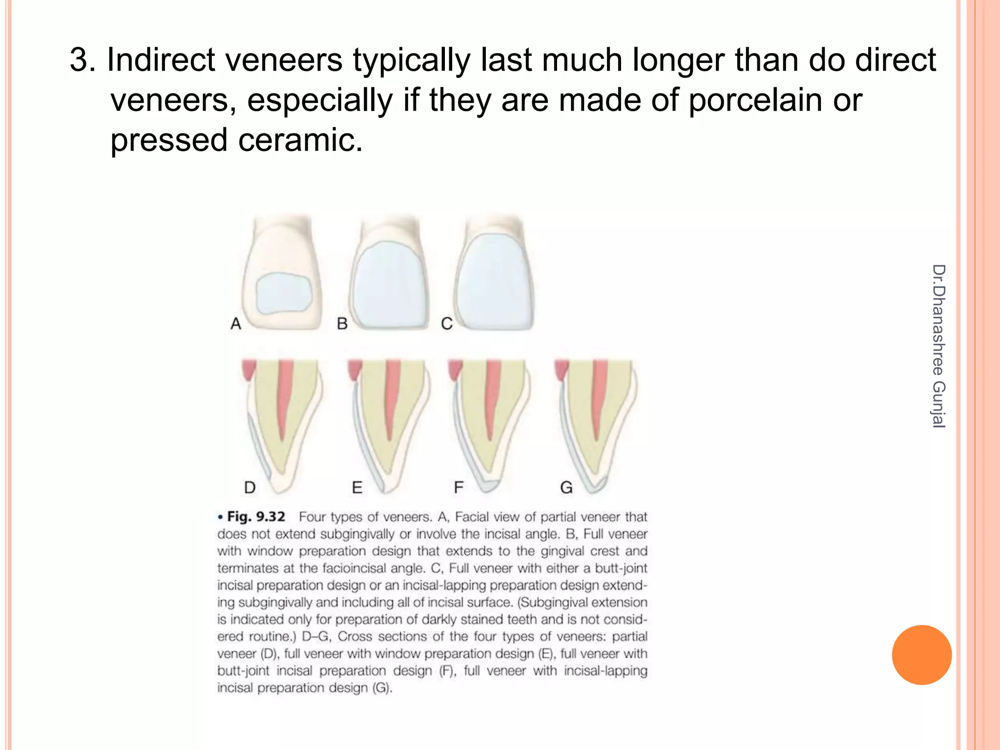 Veneers Dr. Dhanashree Gunjal | PPTX