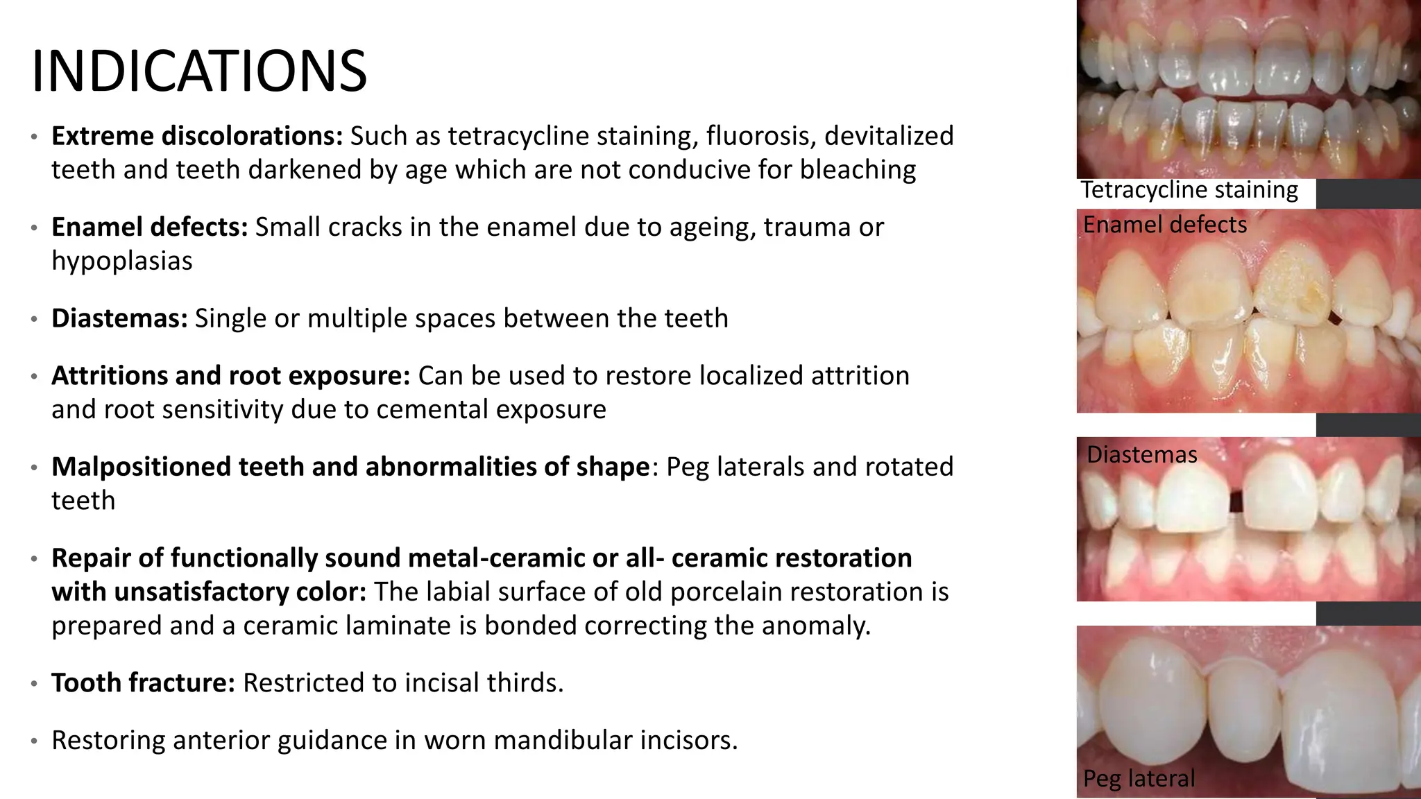 VENEERS: YOUR SMILE'S BEST KEPT SECRET.pptx