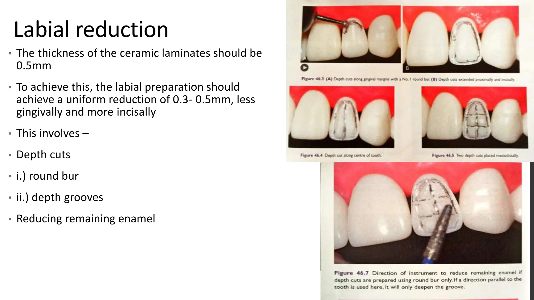 VENEERS: YOUR SMILE'S BEST KEPT SECRET.pptx