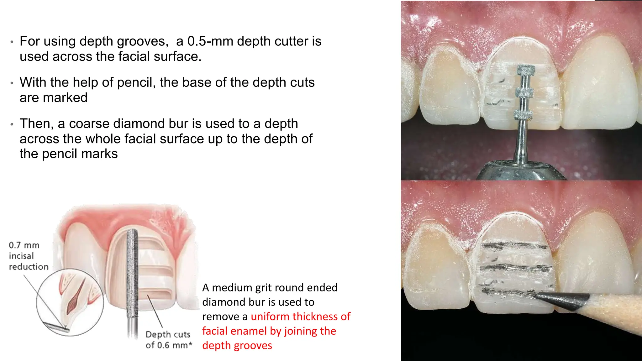 VENEERS: YOUR SMILE'S BEST KEPT SECRET.pptx