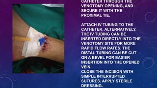 Venesection | PPTX