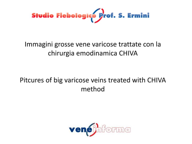 Big Varicose Veins treated with CHIVA Method | PPTX | Heart and ...