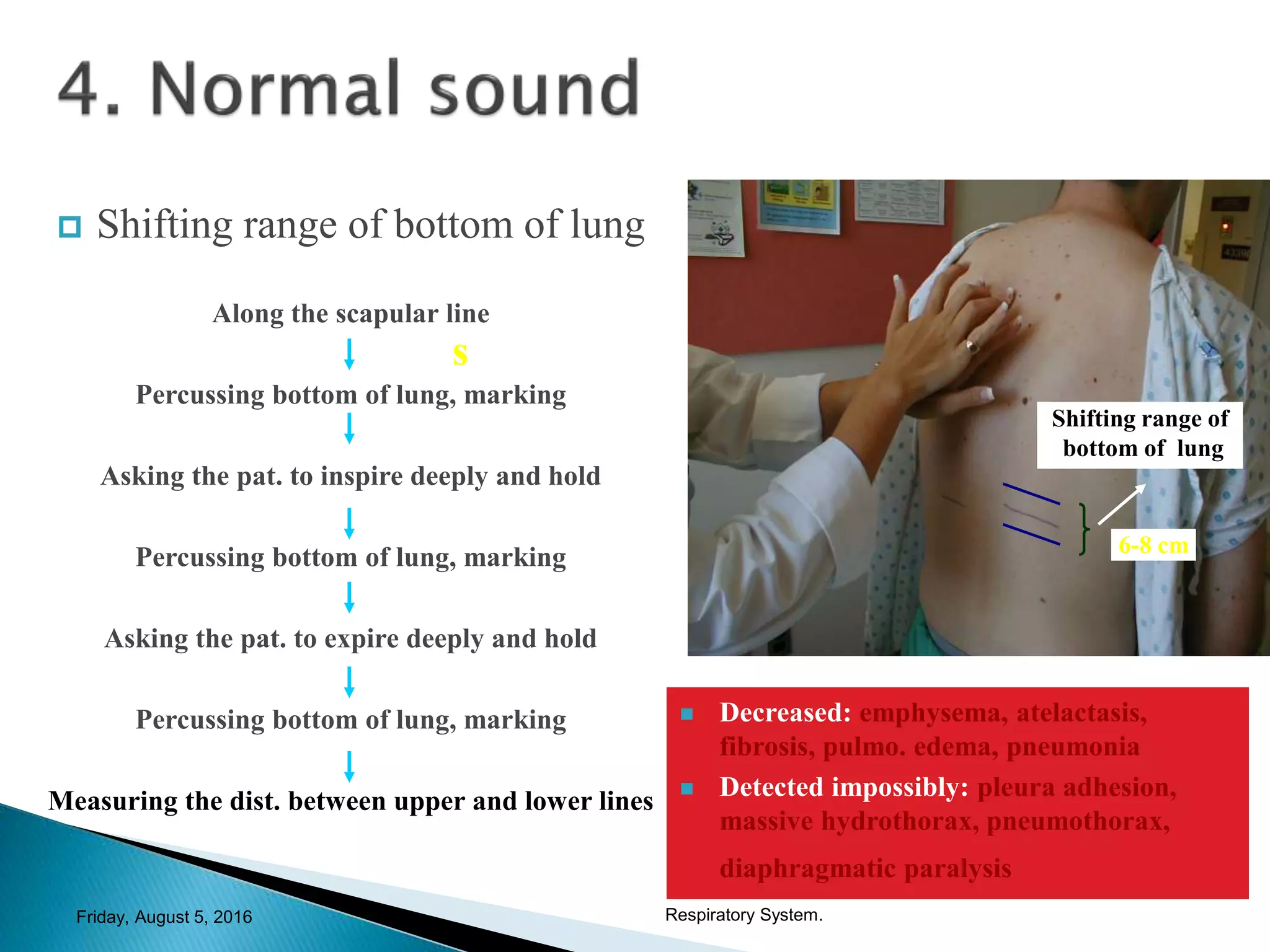 physical examination in RESPIRATORY SYSTEM | PPTX