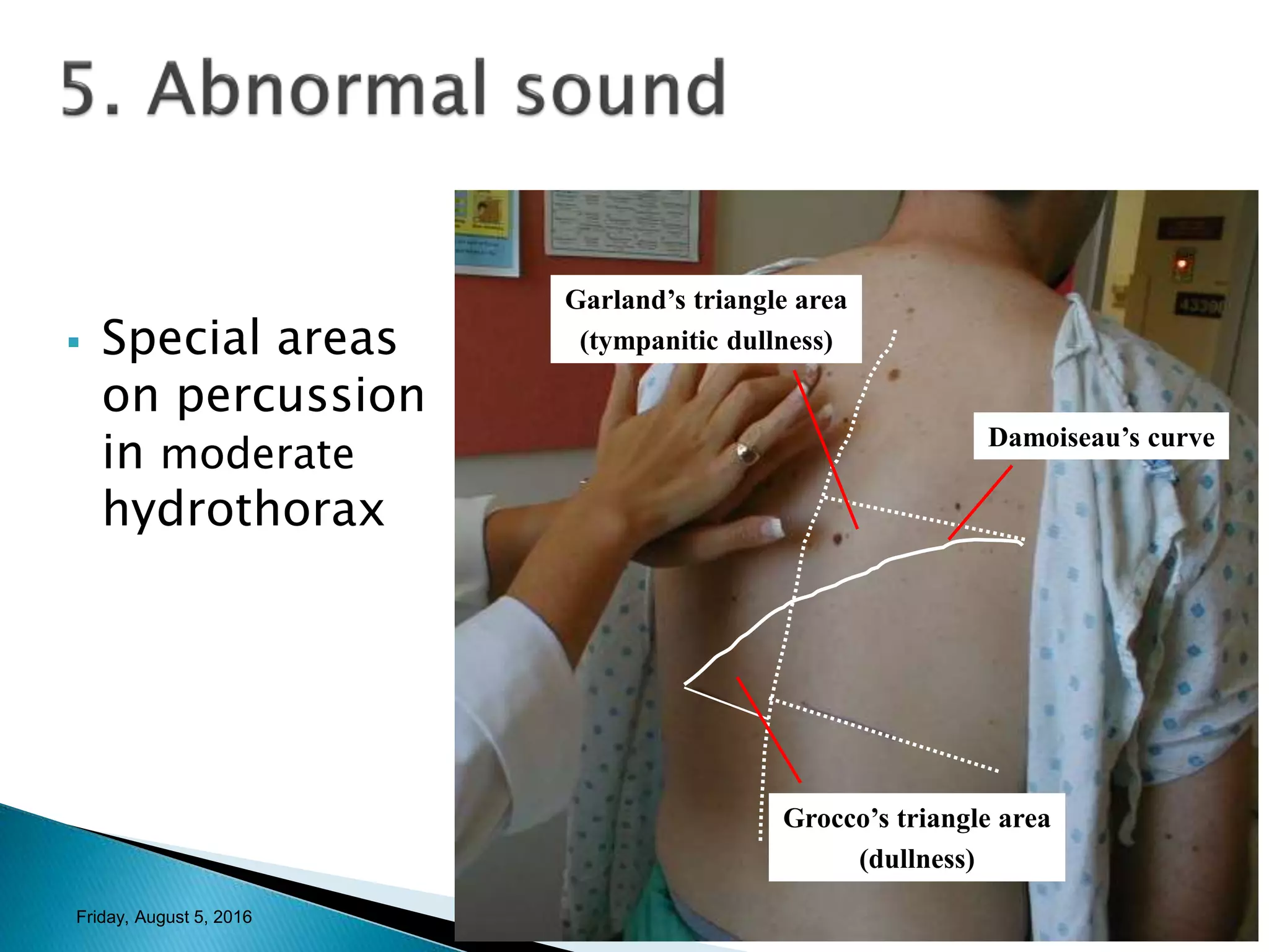physical examination in RESPIRATORY SYSTEM | PPTX
