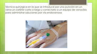 Tecnica de Venoclisis | PPTX