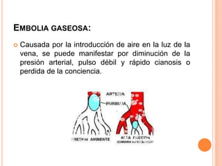 VENOCLISIS CONCEPTO VIAS PERIFERICAS Y CALIBRES DE CATETER | PPTX