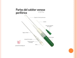 VENOCLISIS CONCEPTO VIAS PERIFERICAS Y CALIBRES DE CATETER | PPTX