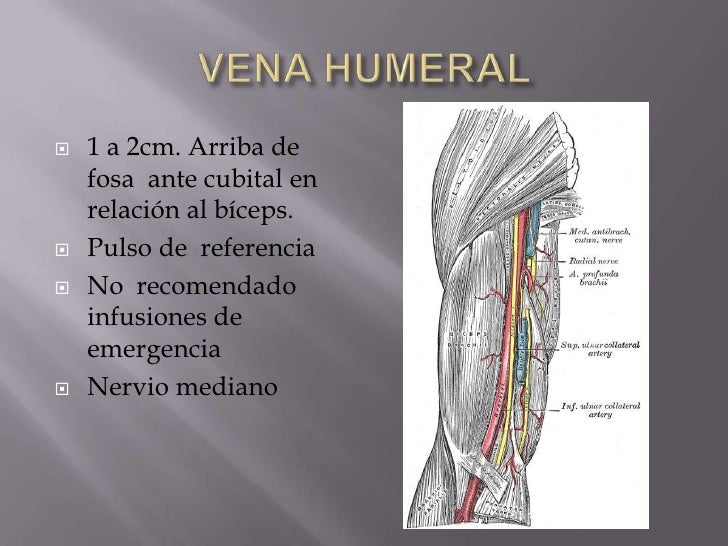 Venodiseccion