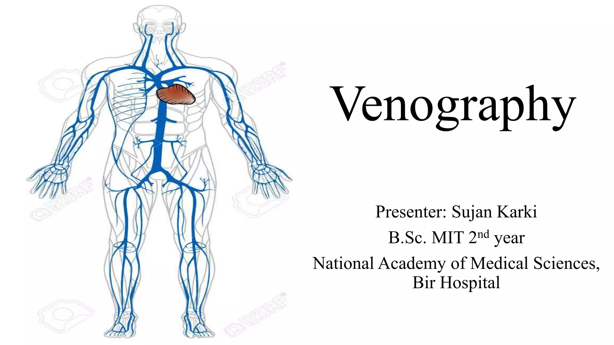 Venography | PPTX
