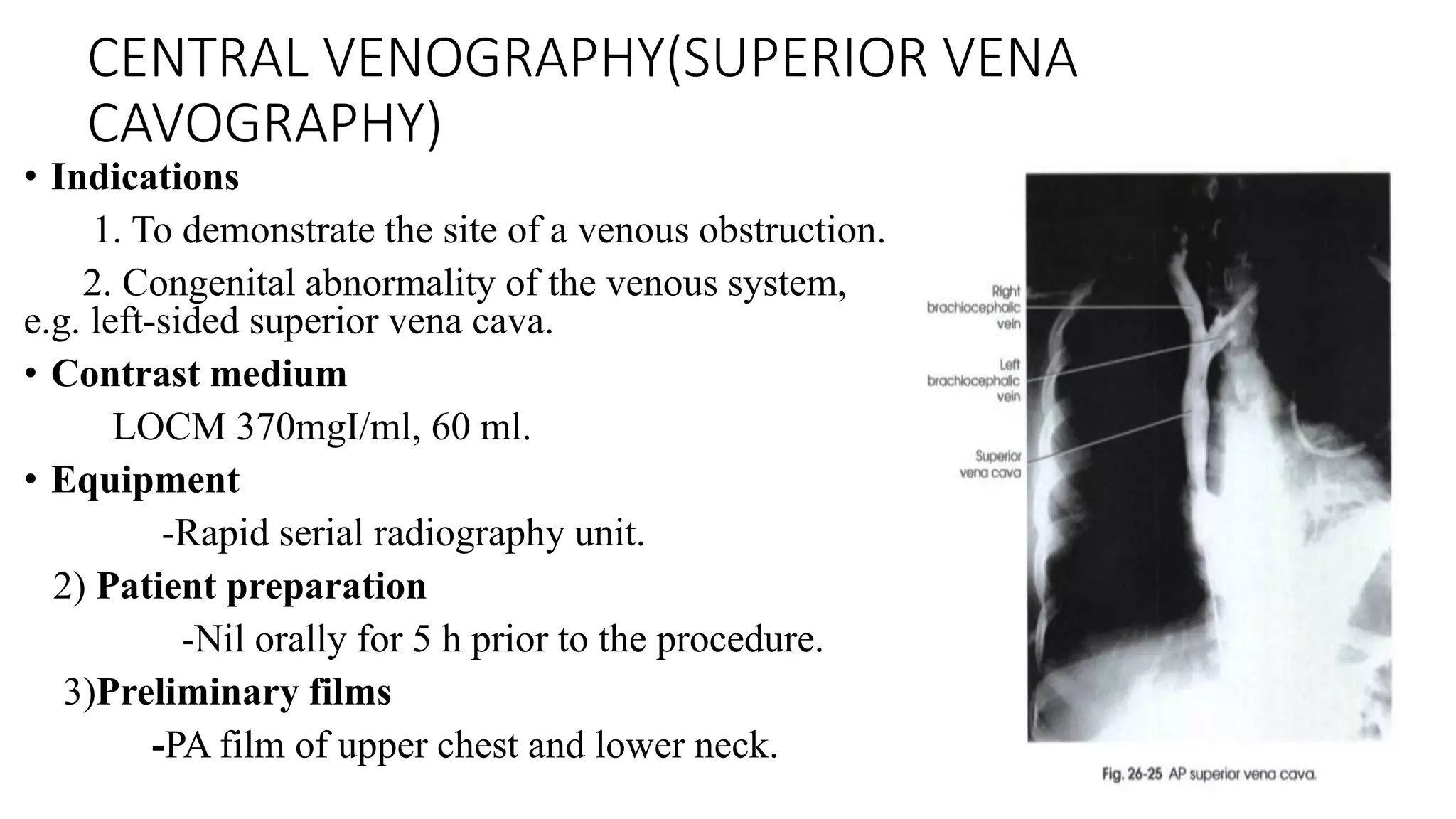 Venography | PPTX