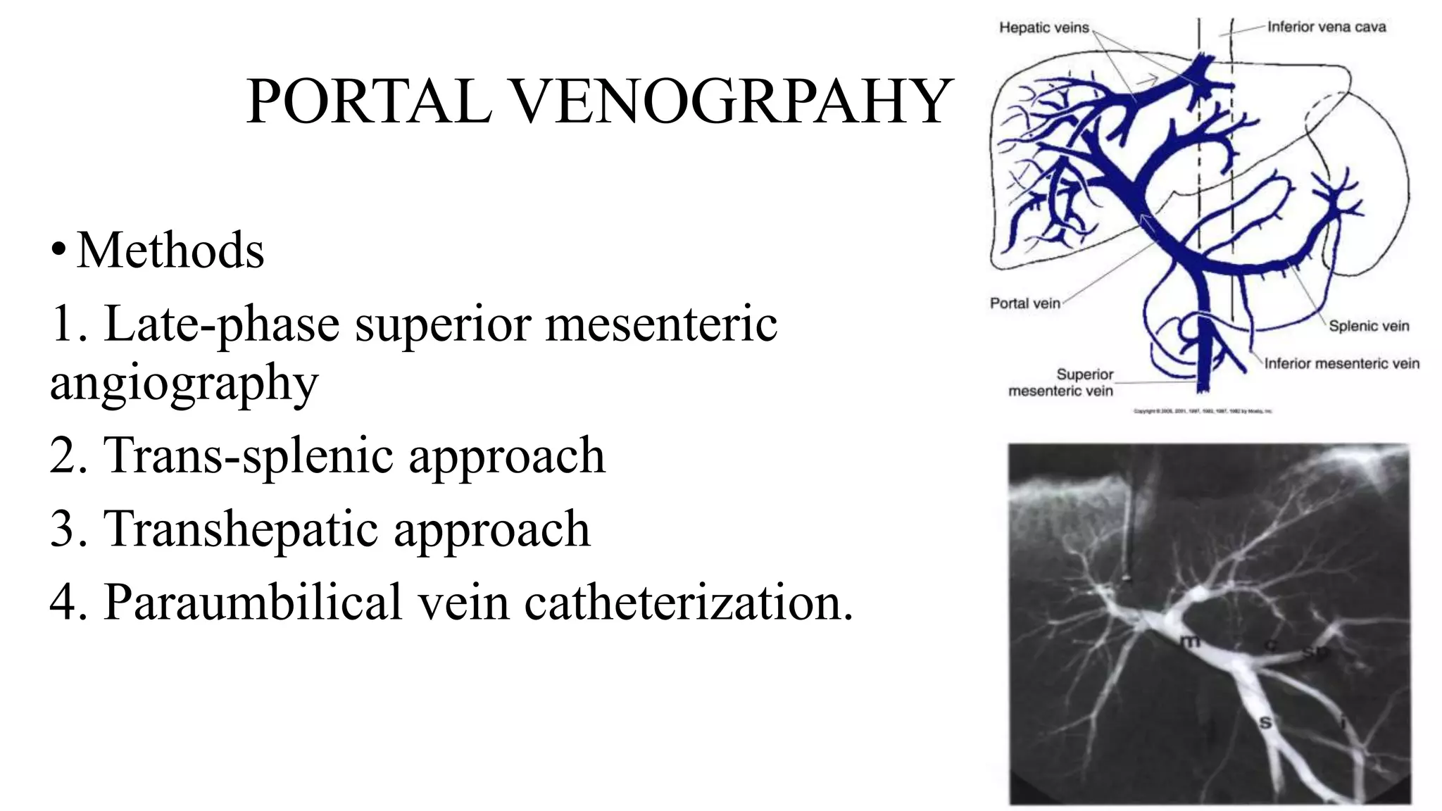 Venography | PPTX