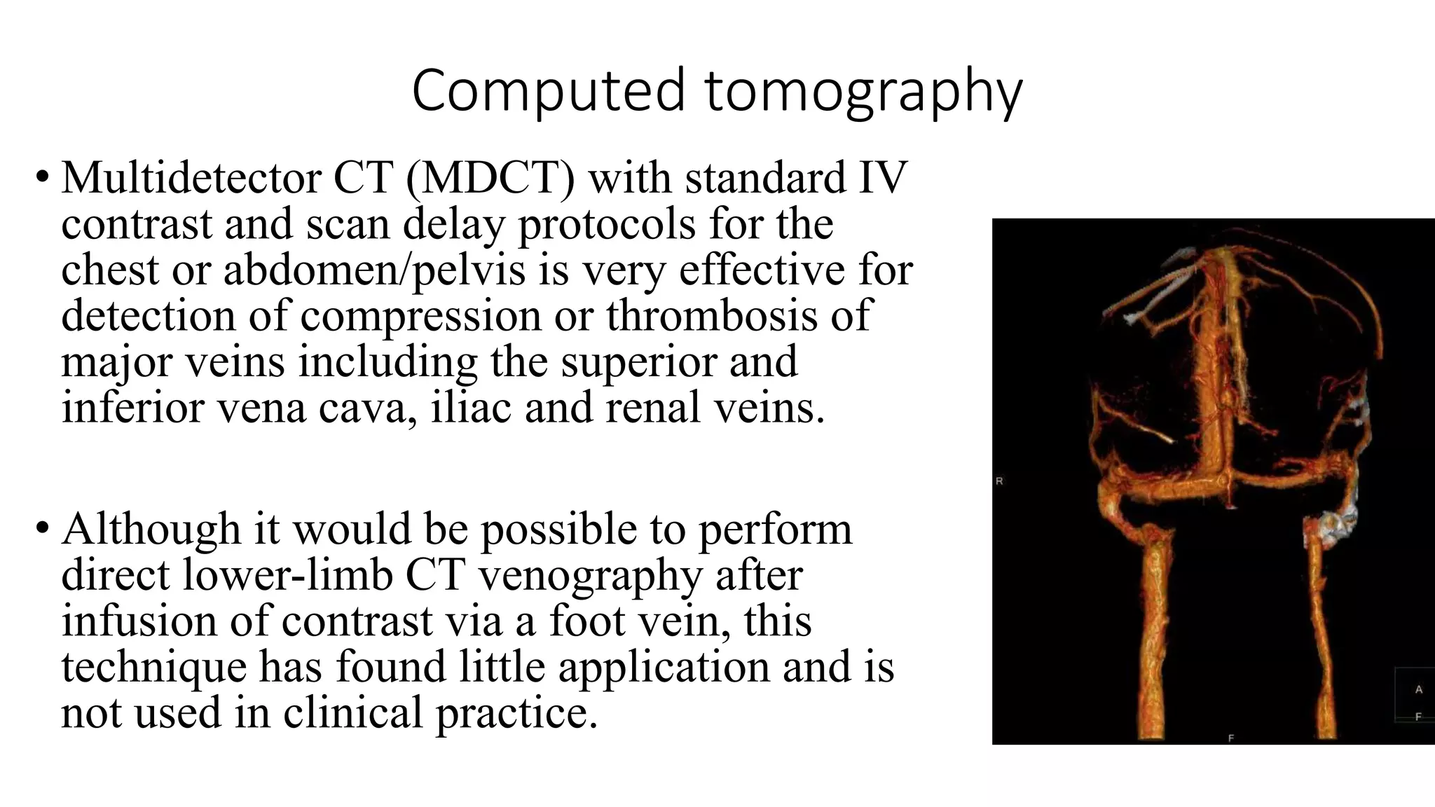 Venography | PPTX