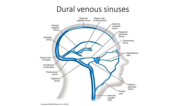 Venography | PPTX | Heart and Cardiovascular Diseases | Diseases and ...