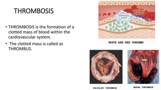 Venography | PPTX | Heart and Cardiovascular Diseases | Diseases and ...