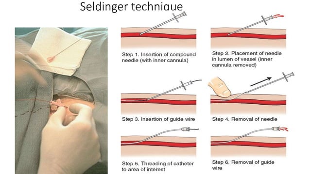 Venography | PPTX | Heart and Cardiovascular Diseases | Diseases and ...