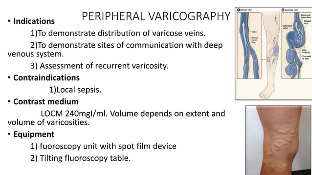 Venography | PPTX | Heart and Cardiovascular Diseases | Diseases and ...