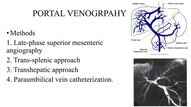Venography | PPTX | Heart and Cardiovascular Diseases | Diseases and ...