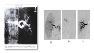 Venography | PPTX