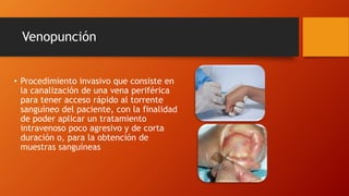 Venopuncion del Recién Nacido | PPTX