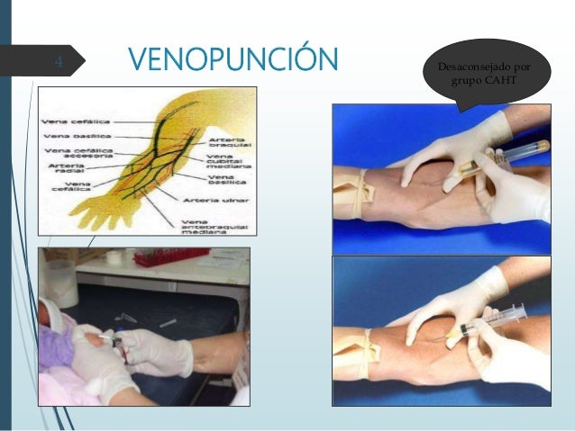 Venopuncion1