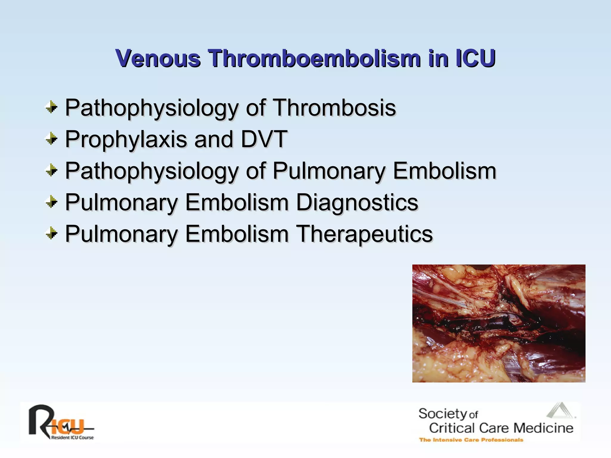 Venous Thromboembolism | PPT