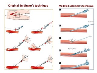 VENOUS ACCESS in CATH-LAB CARDIOLOGY by Syed Fawad Shah Cardiac ...