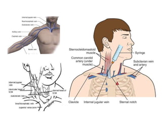 VENOUS ACCESS in CATH-LAB CARDIOLOGY by Syed Fawad Shah Cardiac ...