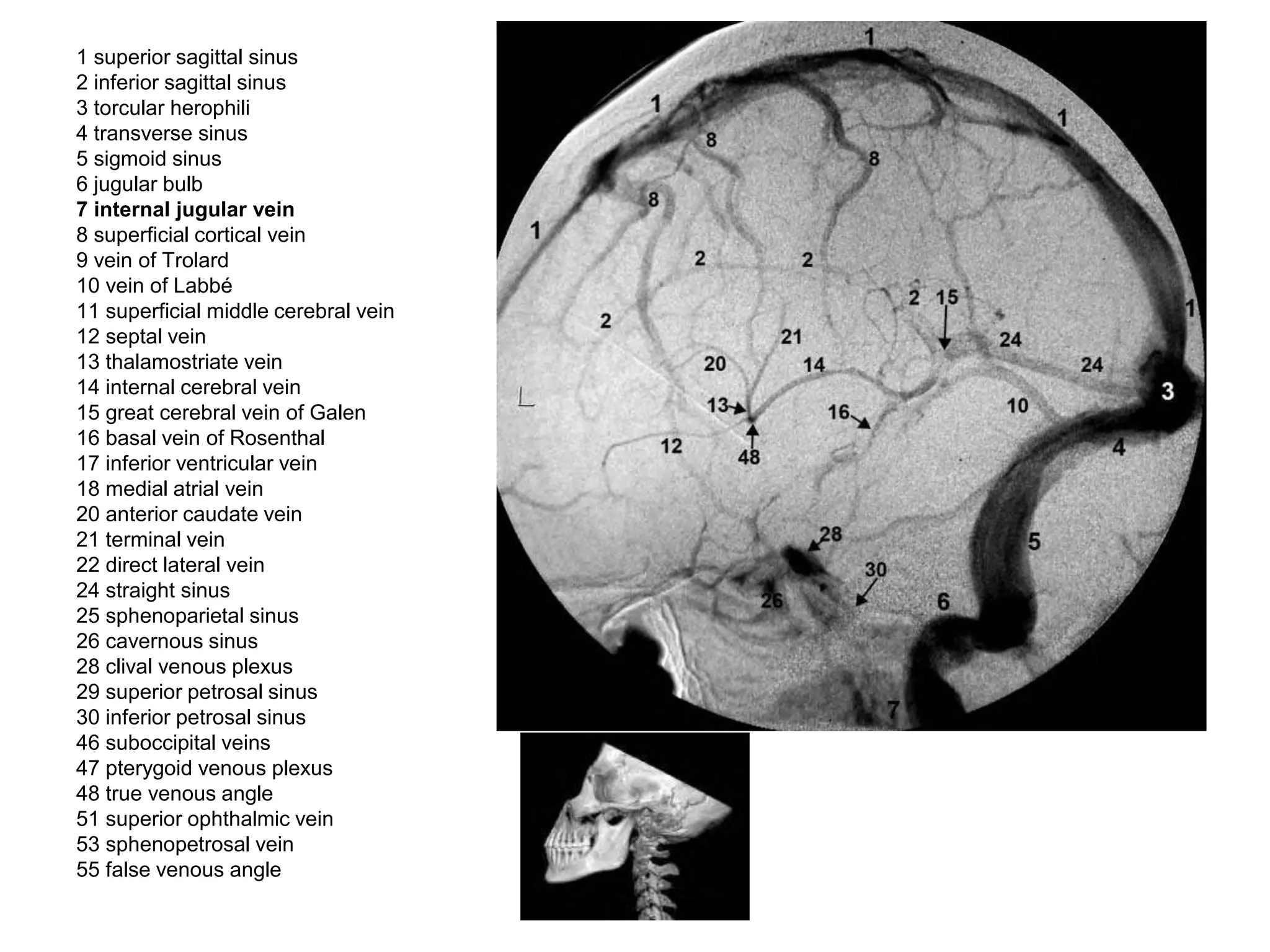 Cerebral Venous anatomy | PPT