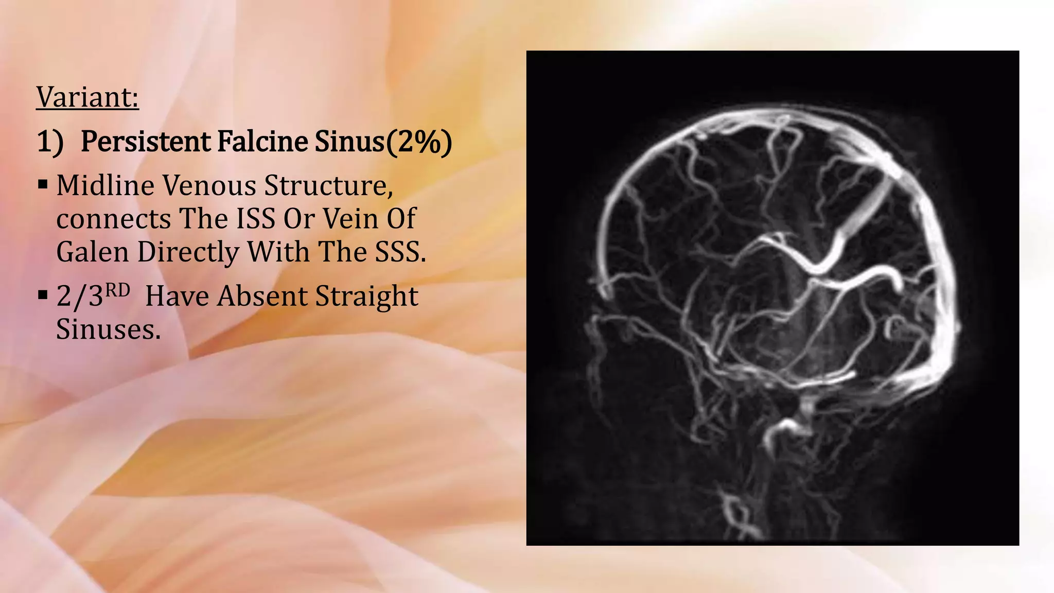 Radiologic Venous Anatomy of Brain | PPTX