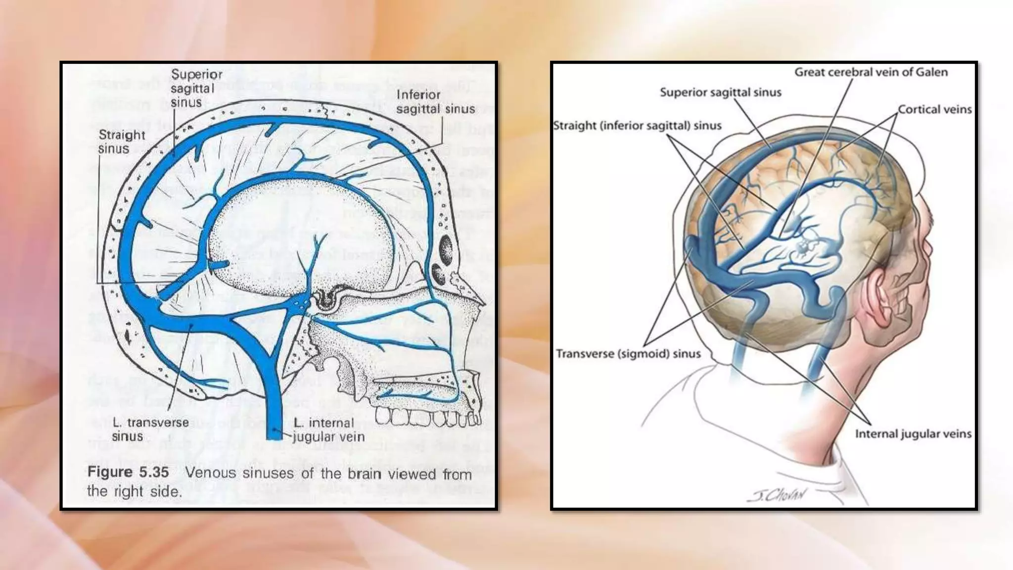 Radiologic Venous Anatomy of Brain | PPTX