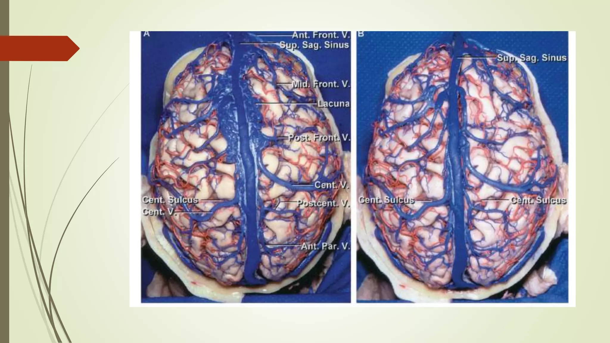 Venous anatomy of the brain | PPTX