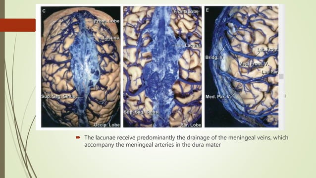 Venous anatomy of the brain | PPTX