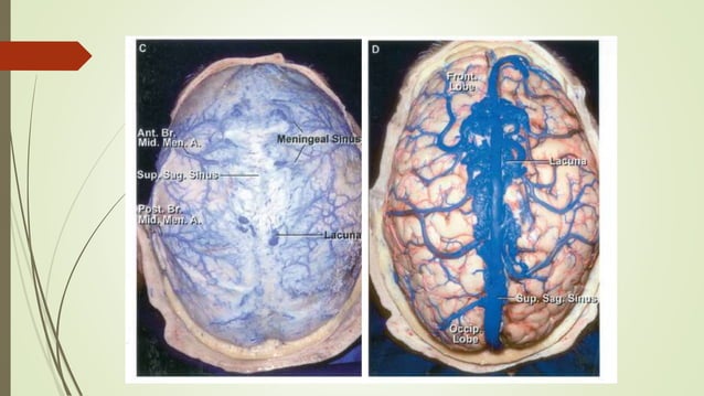 Venous anatomy of the brain | PPTX