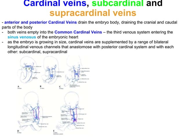 venous anomalies Dr Nikhil.pptx