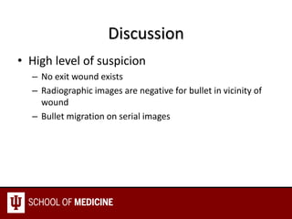 Venous Bullet Embolization Presentation Final.pptx