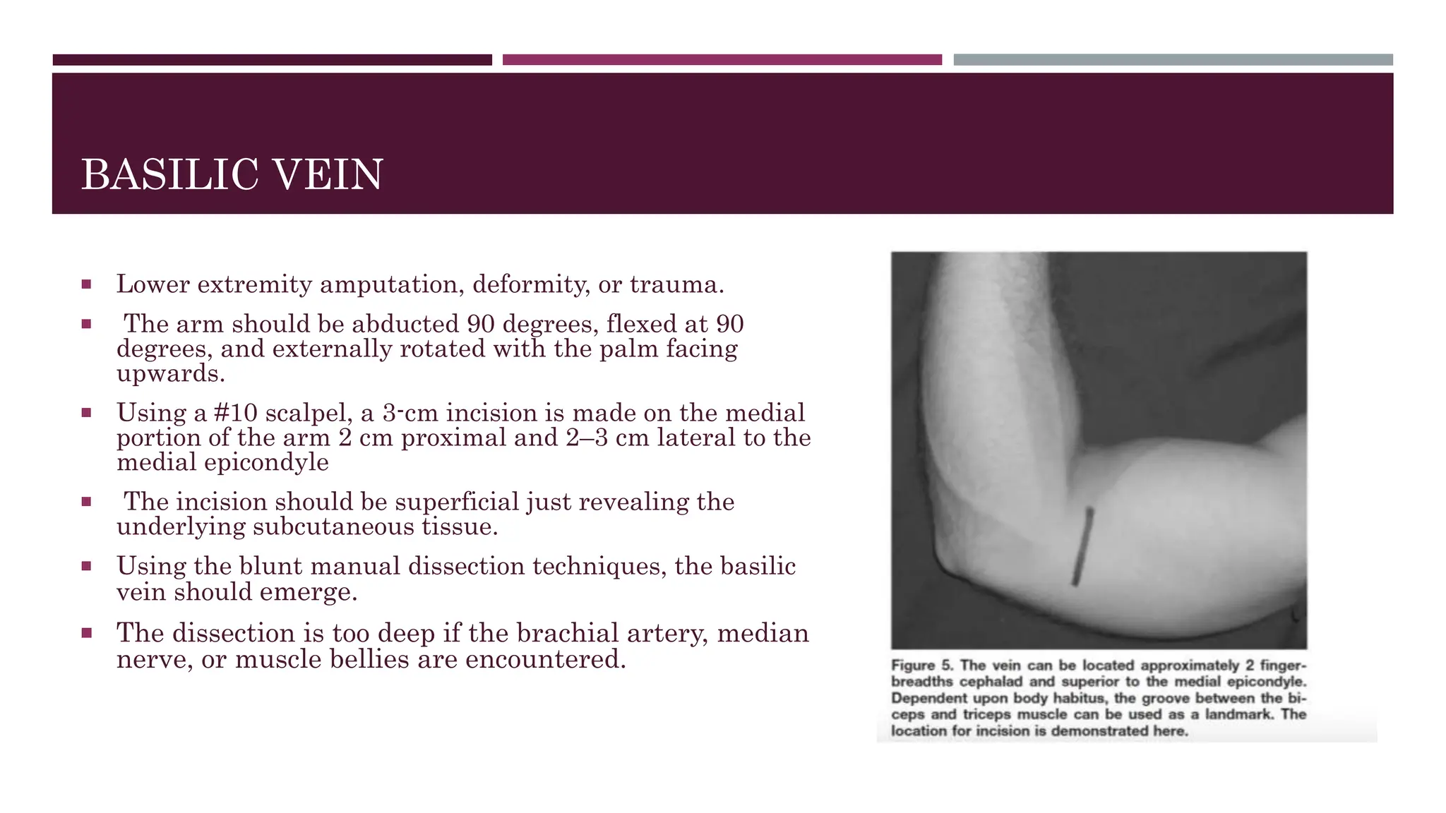 VENOUS CUT DOWN Procedure ppt presntation | PPTX