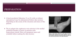 VENOUS CUT DOWN Procedure ppt presntation | PPTX