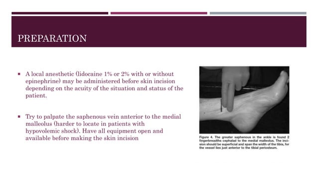 VENOUS CUT DOWN Procedure ppt presntation | PPTX | First Aid | Injuries