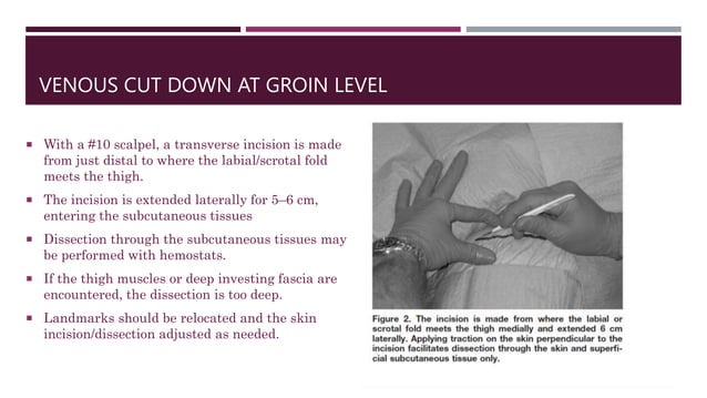 VENOUS CUT DOWN Procedure ppt presntation | PPTX | First Aid | Injuries