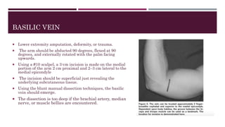 VENOUS CUT DOWN Procedure ppt presntation | PPTX