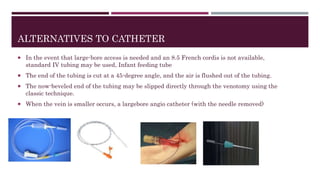 VENOUS CUT DOWN Procedure ppt presntation | PPTX