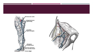 VENOUS CUT DOWN Procedure ppt presntation | PPTX