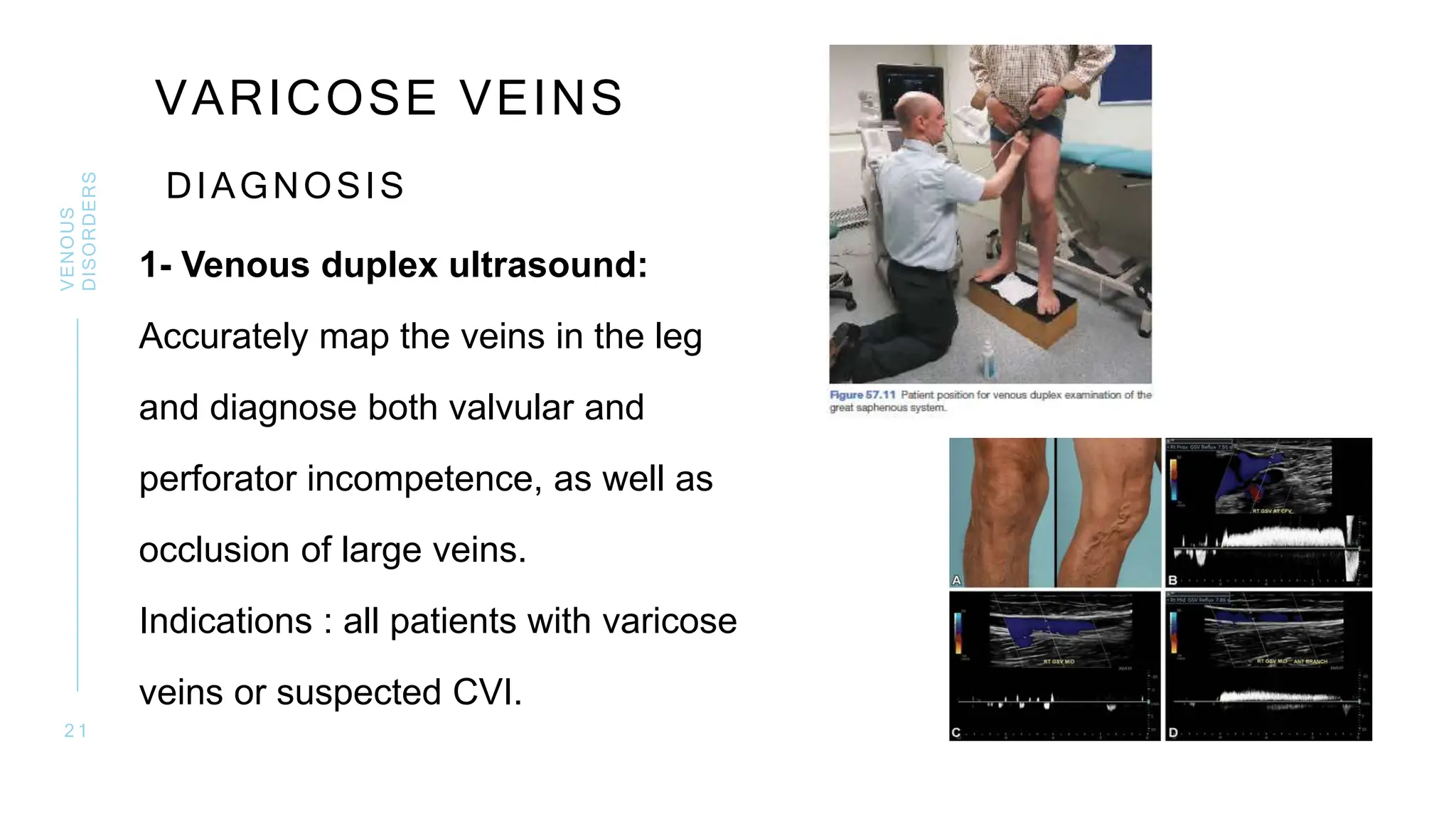Venous disorders of the lower limbs, general surgery | PPTX