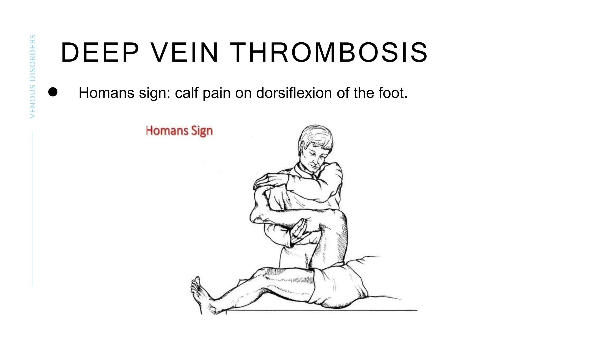 Venous disorders of the lower limbs, general surgery | PPTX